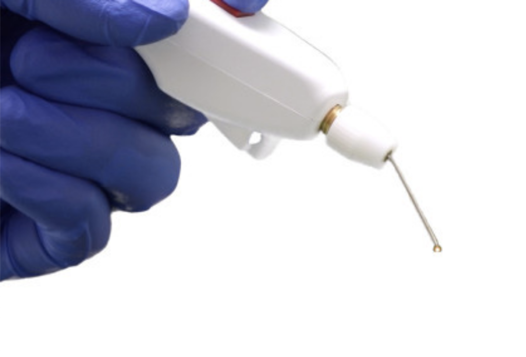 PlexR (plasmapen) – zonder incisies - Birgit Muylle